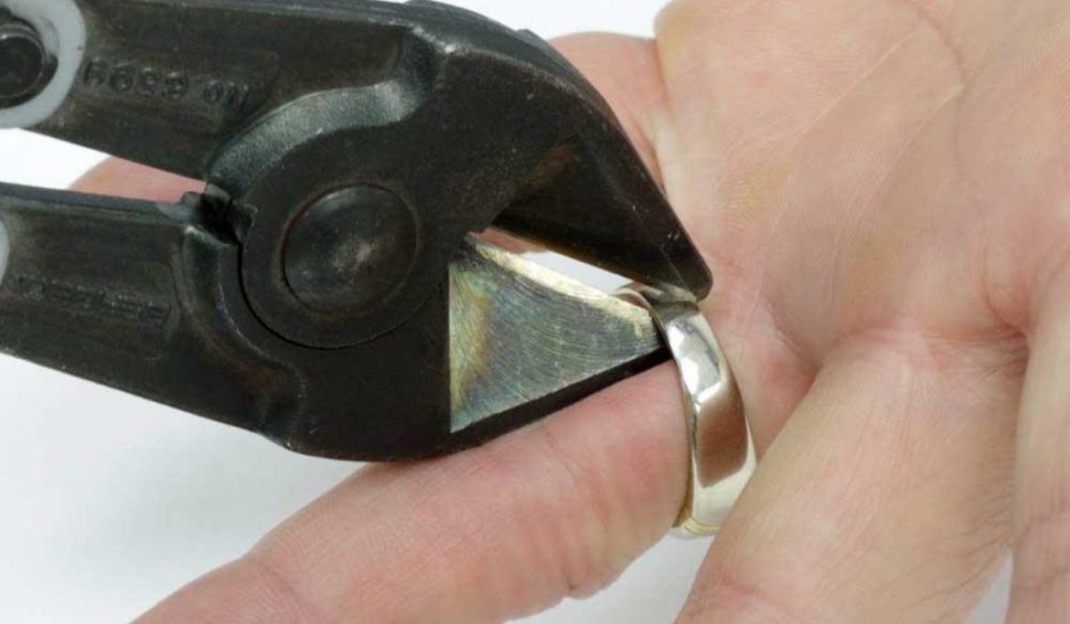 How to remove ring from finger | Ring removal | Fabulously